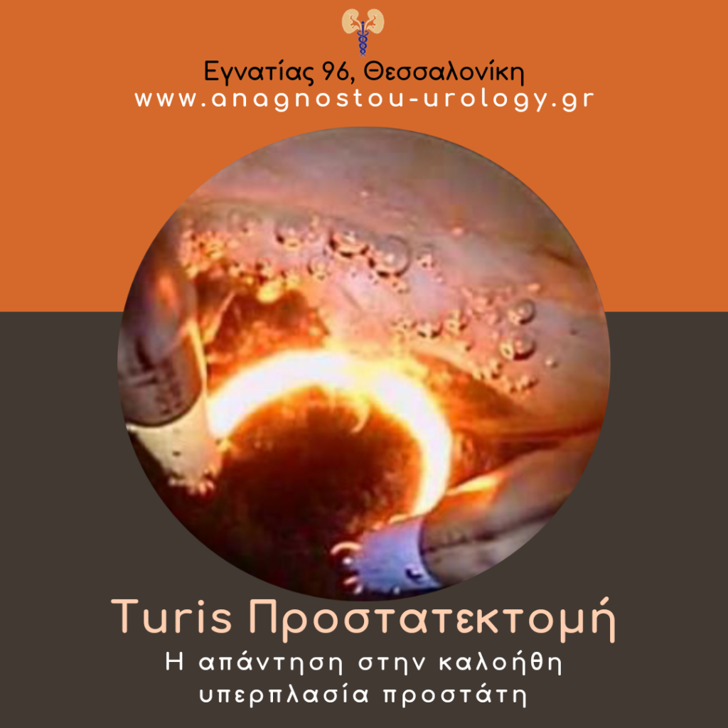 Ουρολόγος Θεσσαλονίκη | Αναγνώστου Ιωάννης